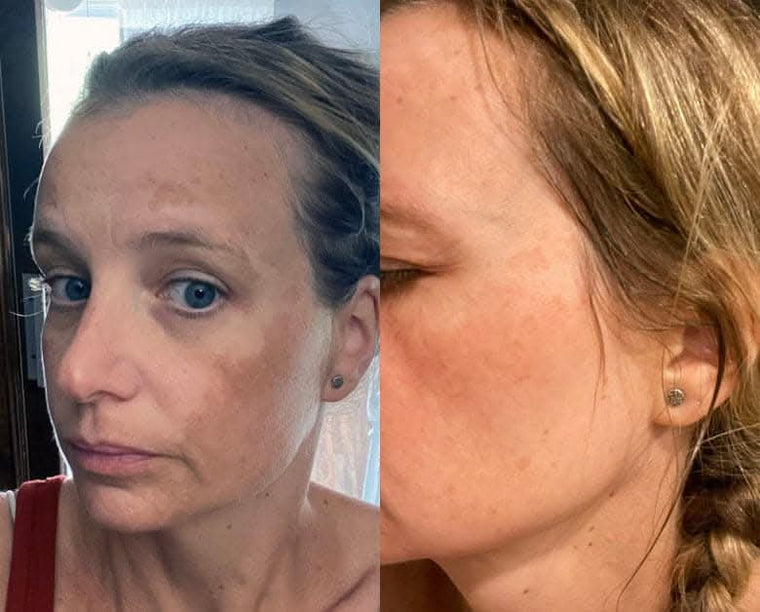 Complete Regimen Kit – Civant