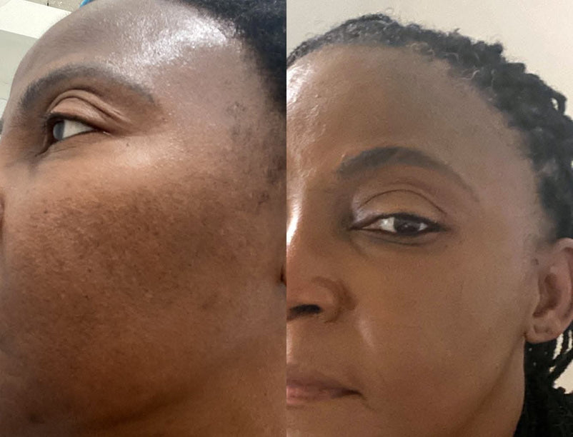 Complete Regimen Kit – Civant